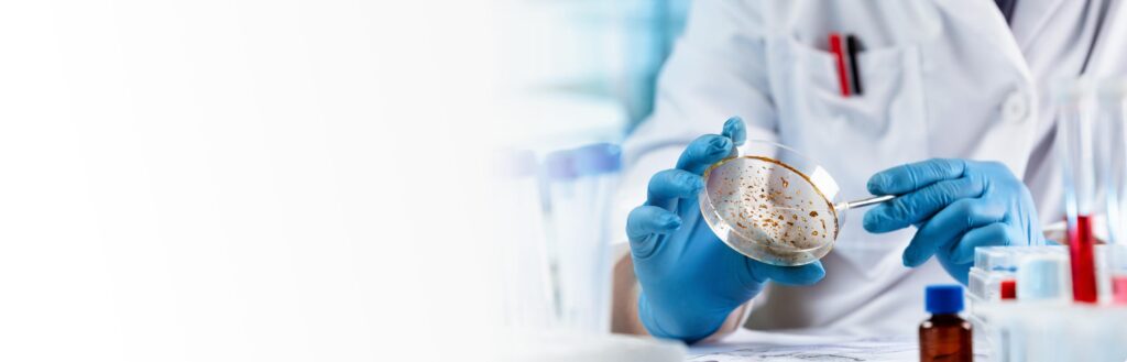 Fungal Resistance - Microbac Laboratories