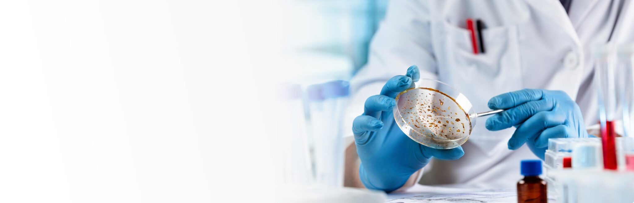 Fungal Resistance - Microbac Laboratories